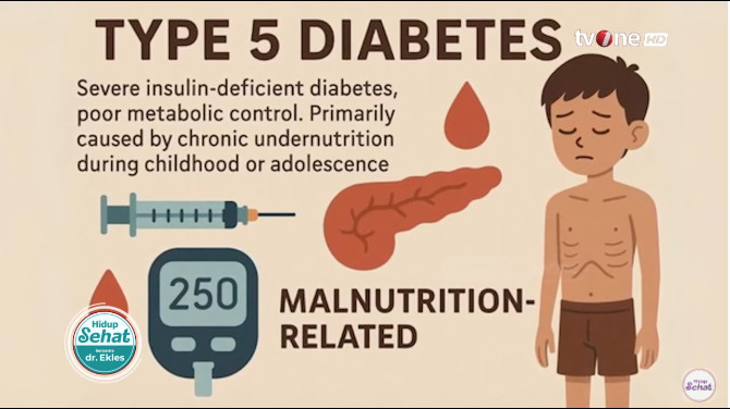 Jarang Diketahui, Apa Itu Diabetes Tipe 5? Dokter Jelaskan Penyeb dan ...